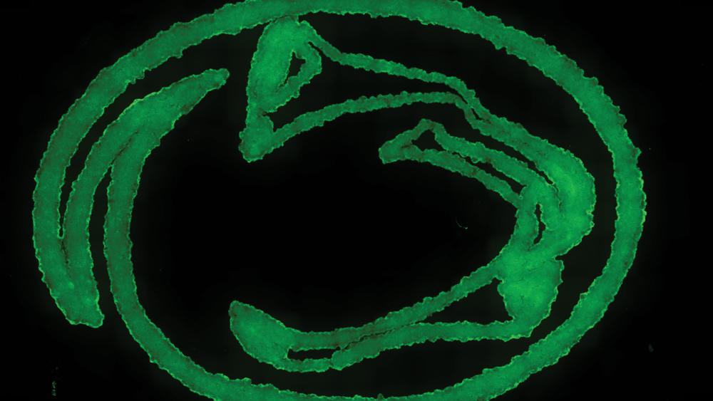 New granular hydrogel bioink could expand possibilities for tissue ...