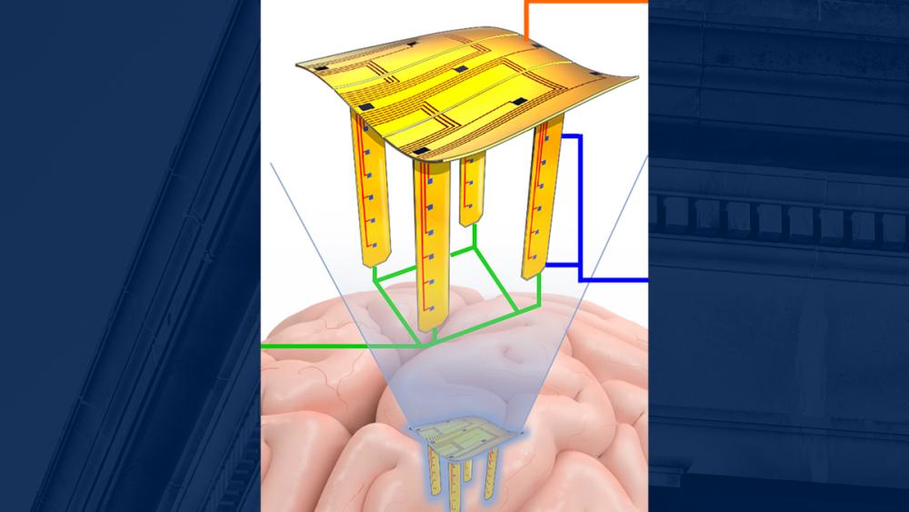 Pop-up electrode device could help with 3D mapping of the brain | Penn ...
