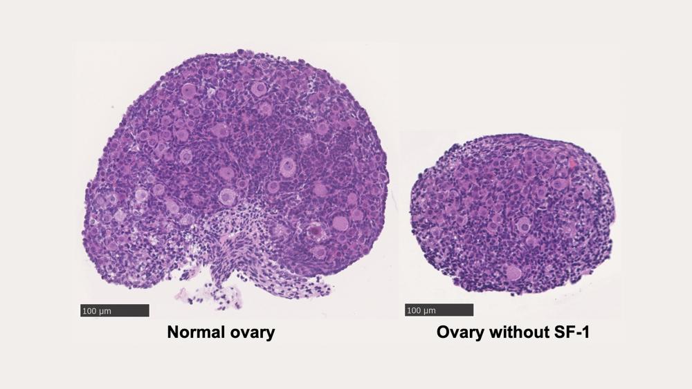 Newly identified protein function may reveal understanding of lifetime ...