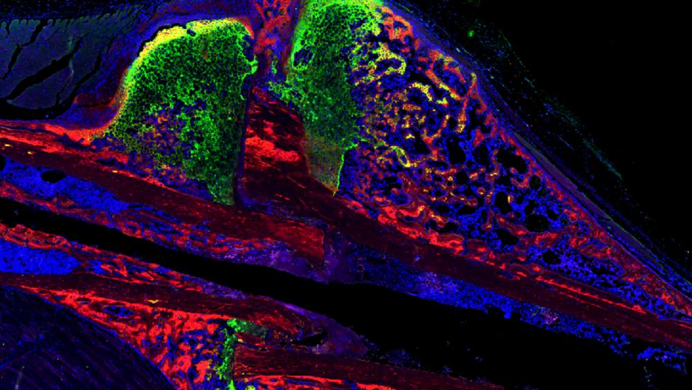 CBD and CBG may promote bone fracture healing, manage pain | Penn State ...