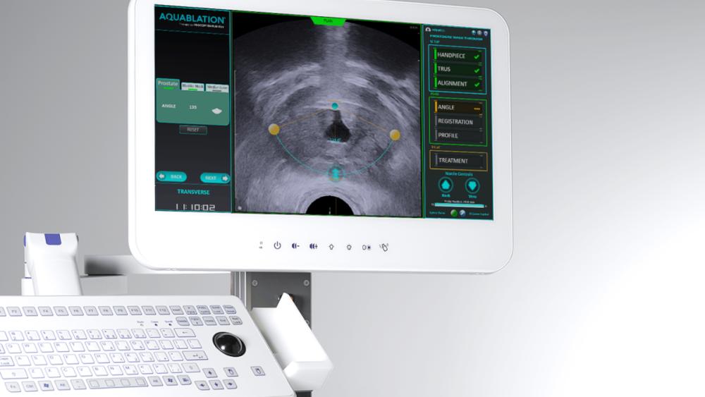 Penn State Health now offering Aquablation therapy to treat enlarged ...