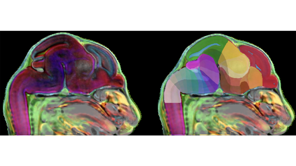 Researchers develop 3D atlas of the developing mammalian brain | Penn ...