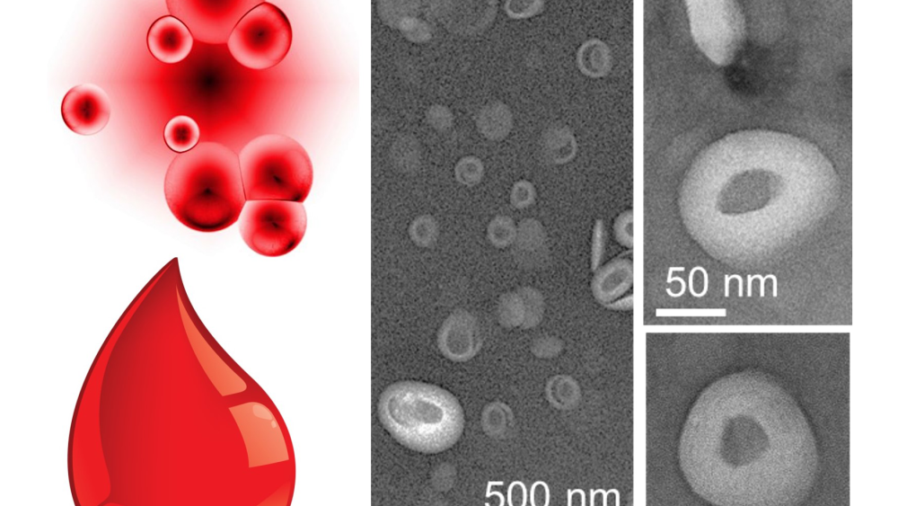 $2.7M NIH grant to fund next generation of synthetic blood | Penn State ...