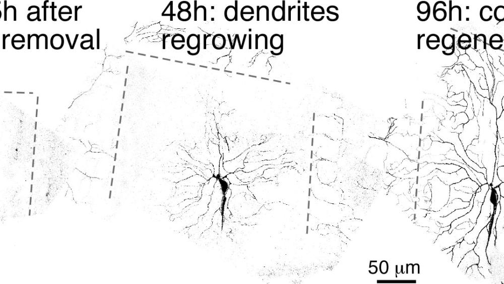 Researchers find new pathway for neuron repair | Penn State University