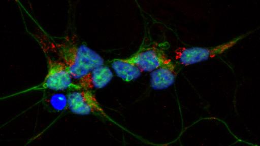 Investigating synthesis of vital cellular components using synthetic ...