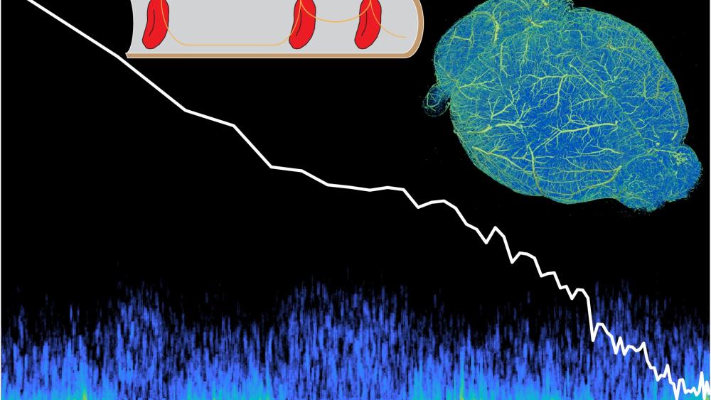 Red blood cell 'traffic' contributes to changes in brain oxygenation ...