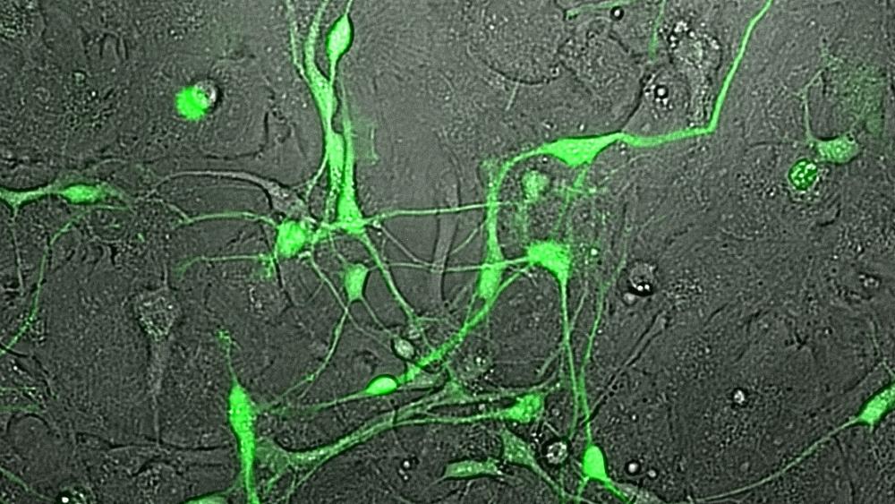 Biologist awarded $1.8M to study neuronal reprograming for spinal cord ...